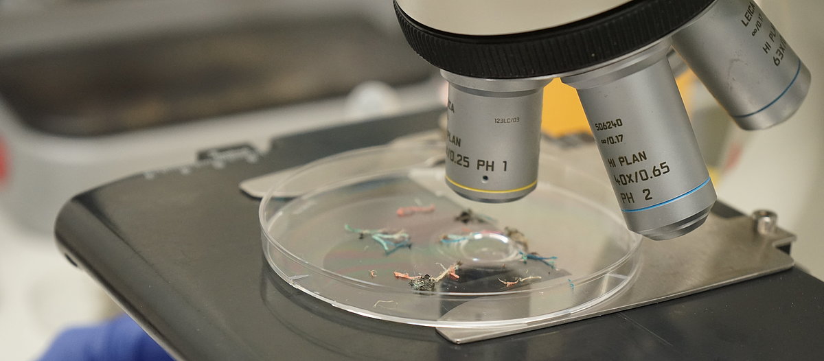 Mix-Up: New Technique to Find Accumulated Microplastics in Humans